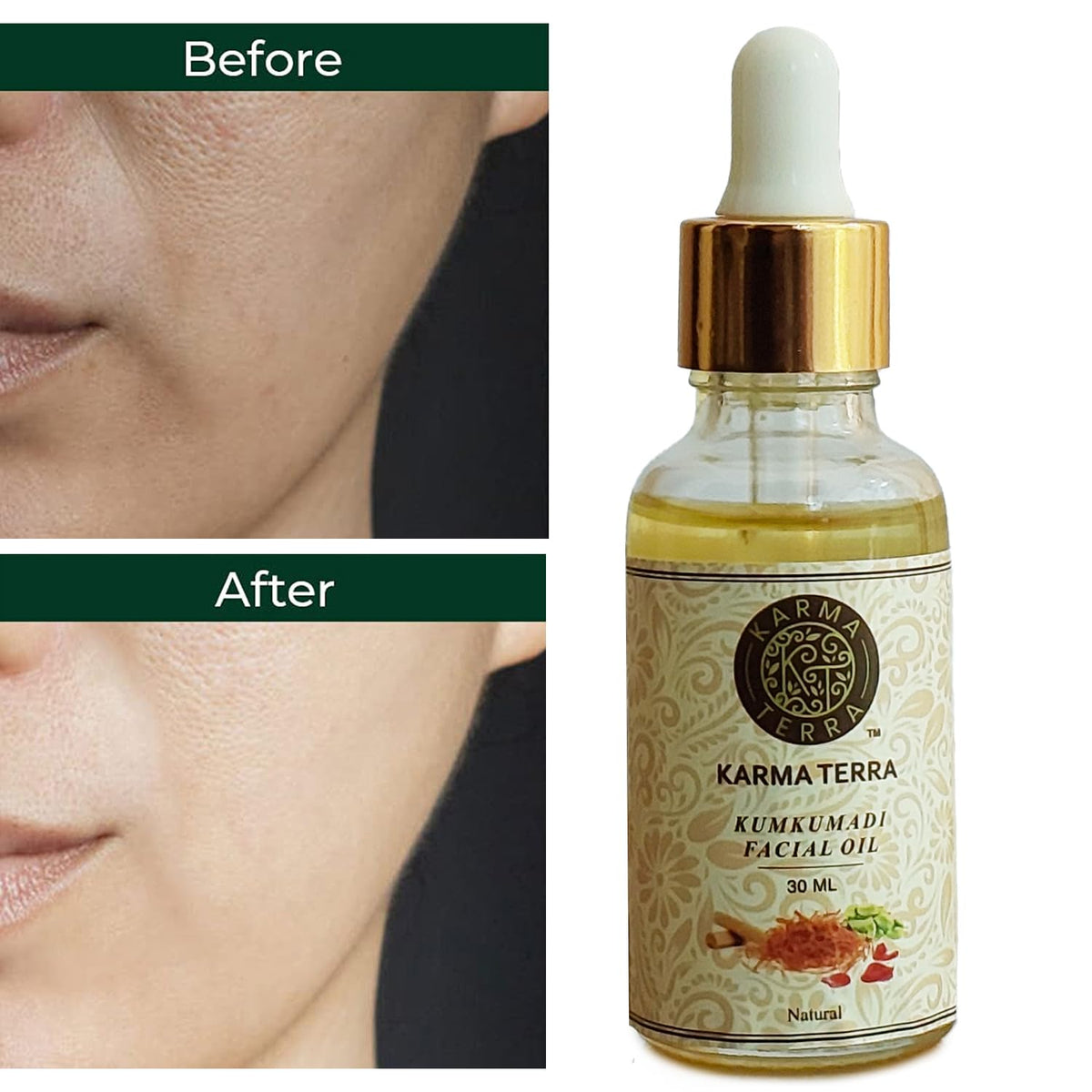 Karmaterra Kumkumadi Face Glowing Oil | Ayurvedic Hydration, Anti-Aging ...